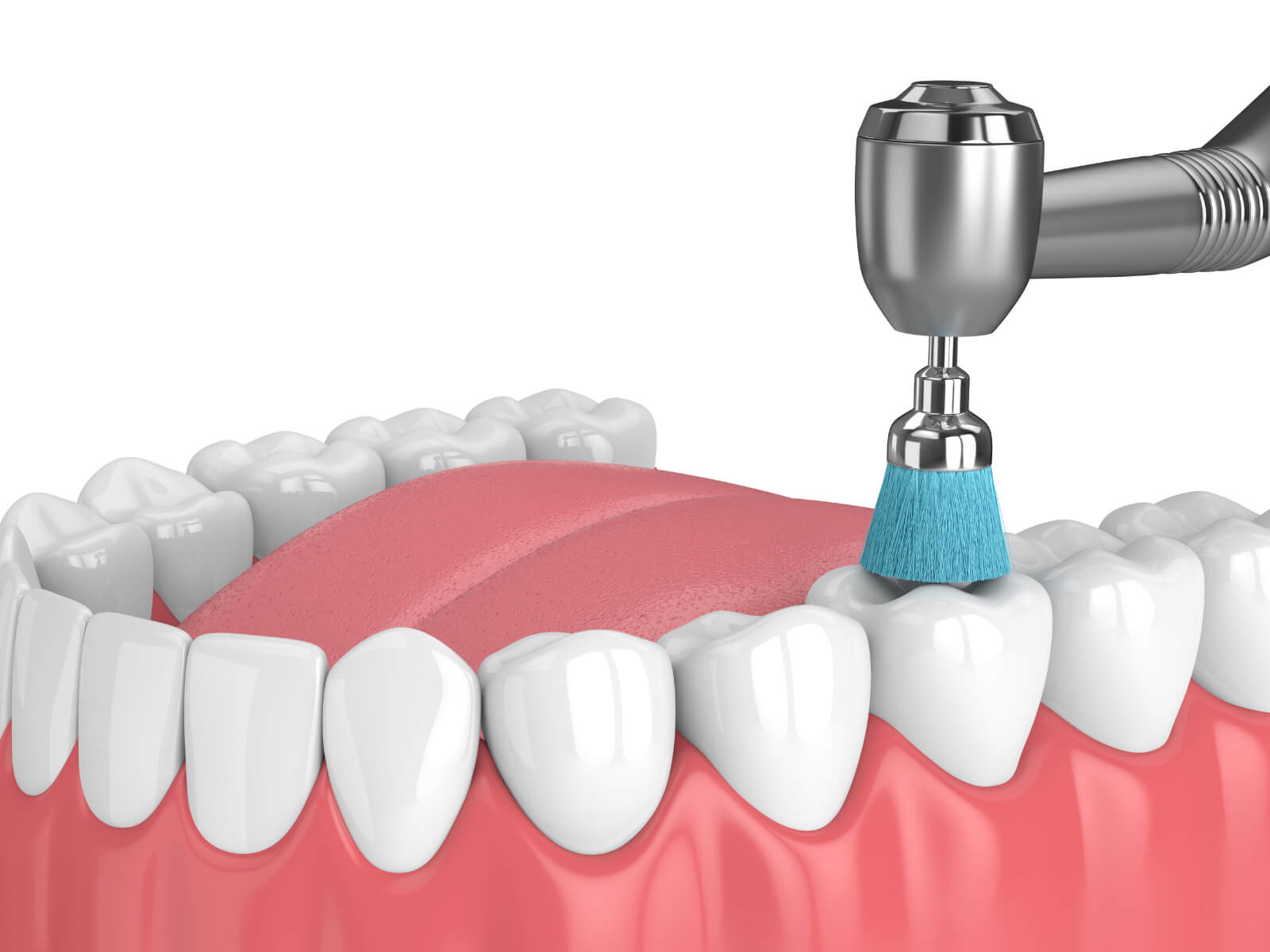 Teeth Scaling And Polishing: Painful or Completely Safe Procedure?